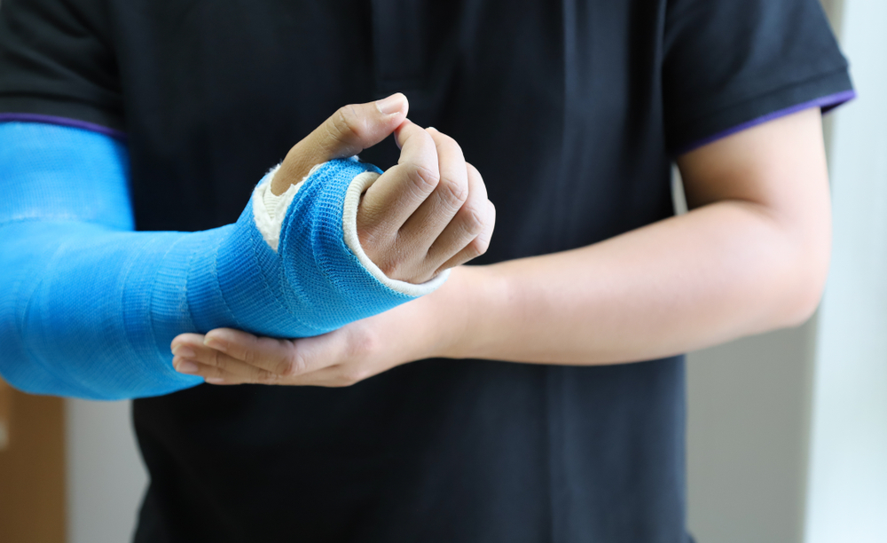 Broken Arm in Car Accidents | Morris Bart Personal Injury Lawyers